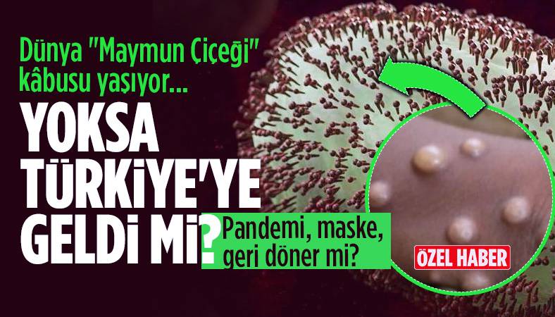 Maymun Çiçeği nedir? Tehlike saçıyor mu? Türkiye'de görüldü mü ...