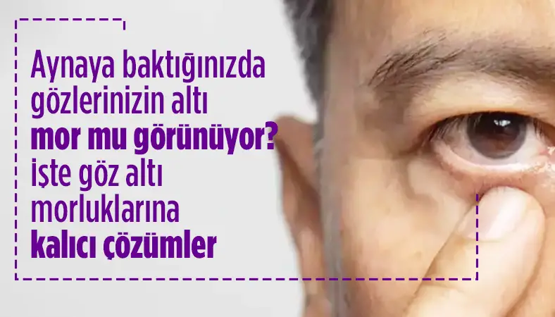 Aynaya baktığınızda gözlerinizin altı mor mu görünüyor? İşte göz altı ...